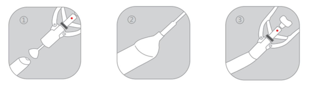 Circumcision – ZSR Circumcision